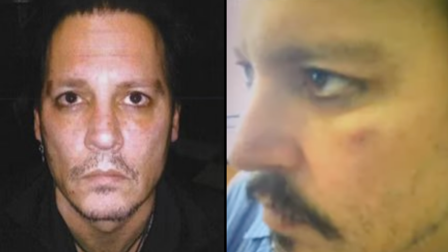 Johnny Depp’s Private Security Guard Shares Photos Of Injuries To The ...