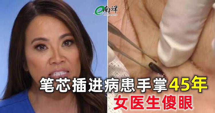 【视频】笔芯插进病患手掌45年 女医生傻眼 | Nestia