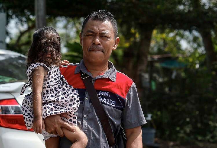 Father of child with 'werewolf syndrome' cherishes King's advice | Nestia