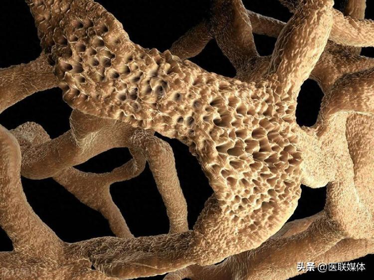 这5个行为，或正在“掏空”骨骼，千万别拖到骨质疏松 | Nestia