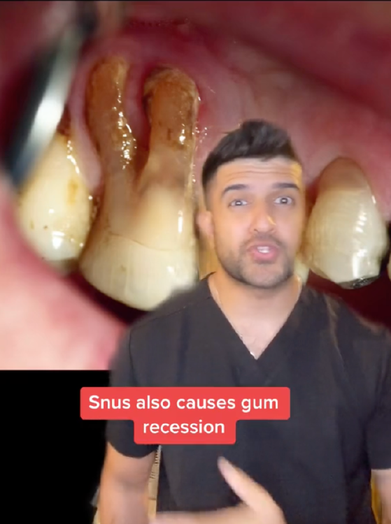 Timeline of everything that happens to your body when you quit taking ...