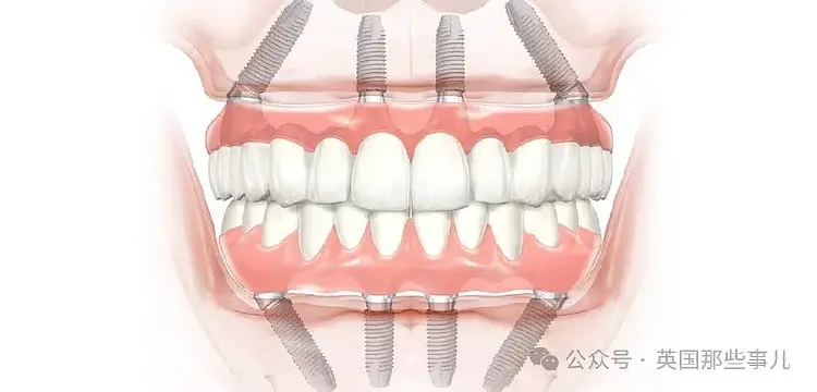 狠人老姐一次性拔全口牙，直接肿成熊猫，整张脸都黑了...（组图） | Nestia