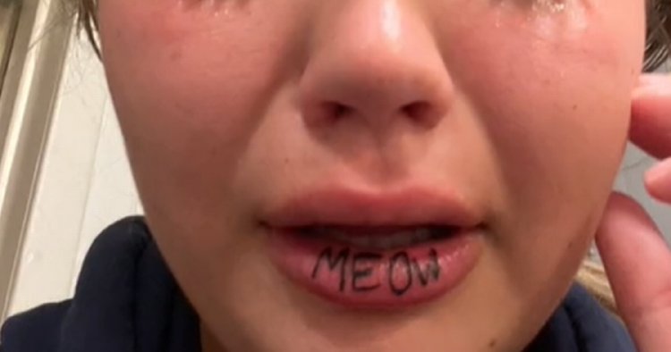 Woman who accidentally got 'meow' tattooed on outside of lip is ...
