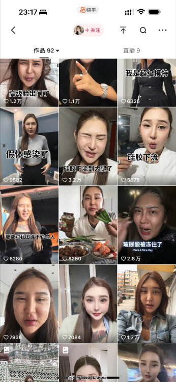 整容狂人︱打400支玻尿酸丰臀却「化脓感染」 女子拍影片曝惨状︱有片 | Nestia