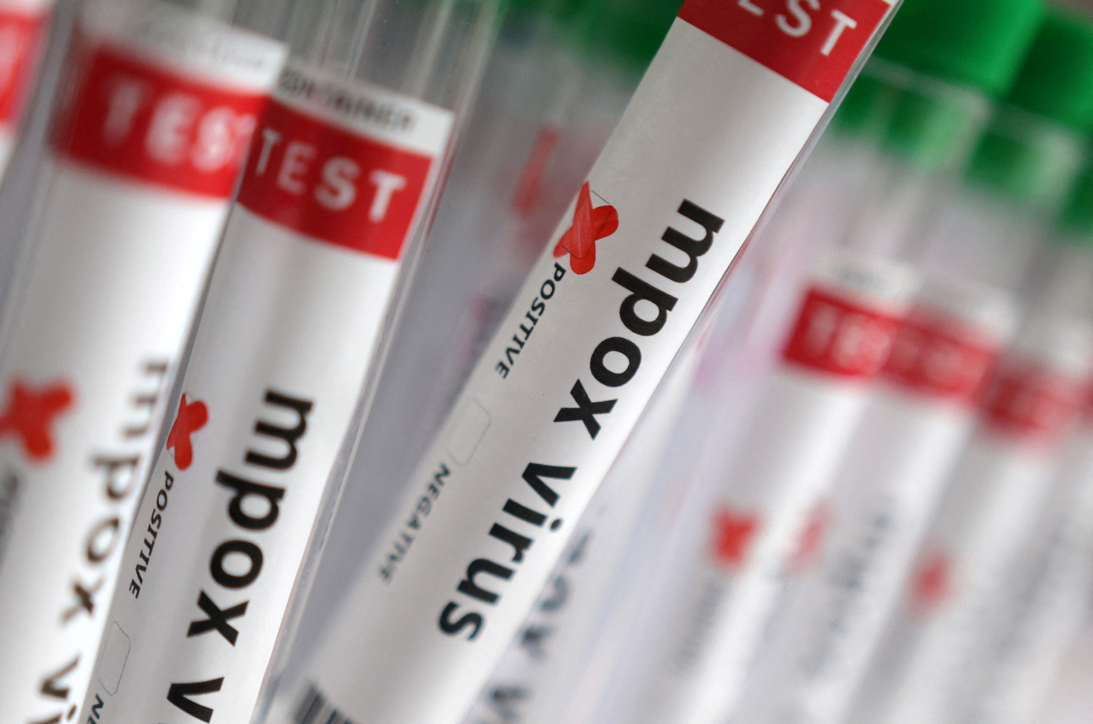 No need to rush for masks, mpox is not the new Covid-19: Experts | Nestia