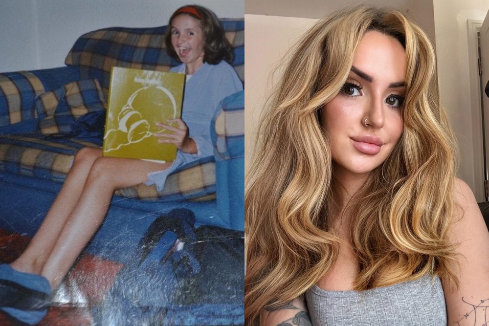 Mum doctors called ‘lanky’ shares journey with rare condition causing ...