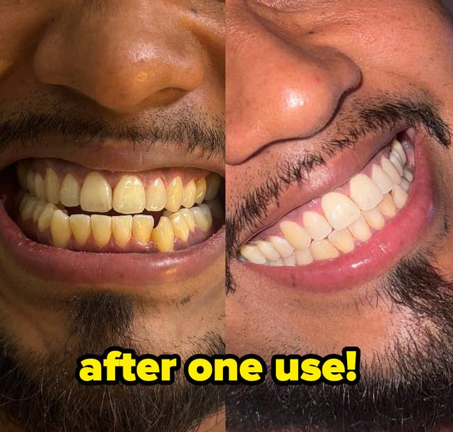 The Only Thing More Shocking Than How Well These 35 Beauty Products Work Is How Damn Cheap They ...